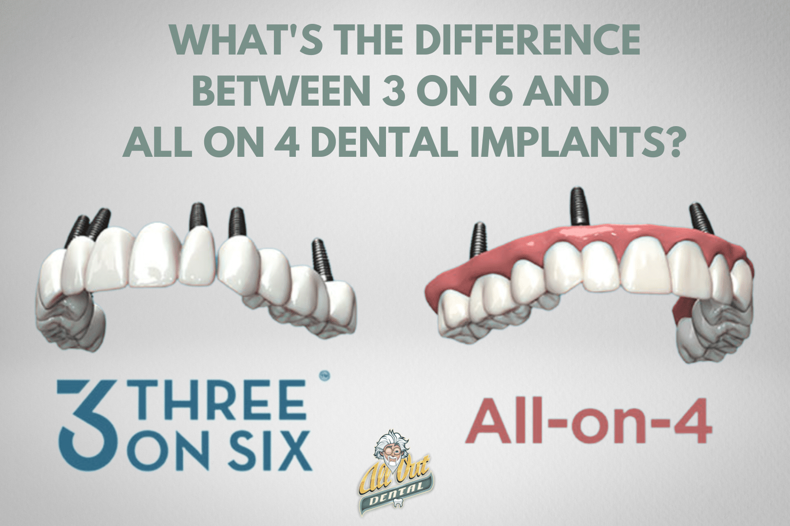 What's the Difference Between 3 on 6 and All on 4 Dental Implants ...