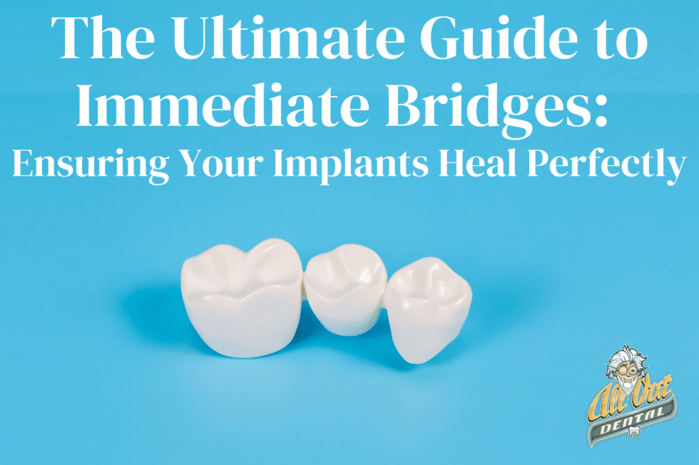 Immediate Bridges: Ensuring Your Implants Heal Perfectly