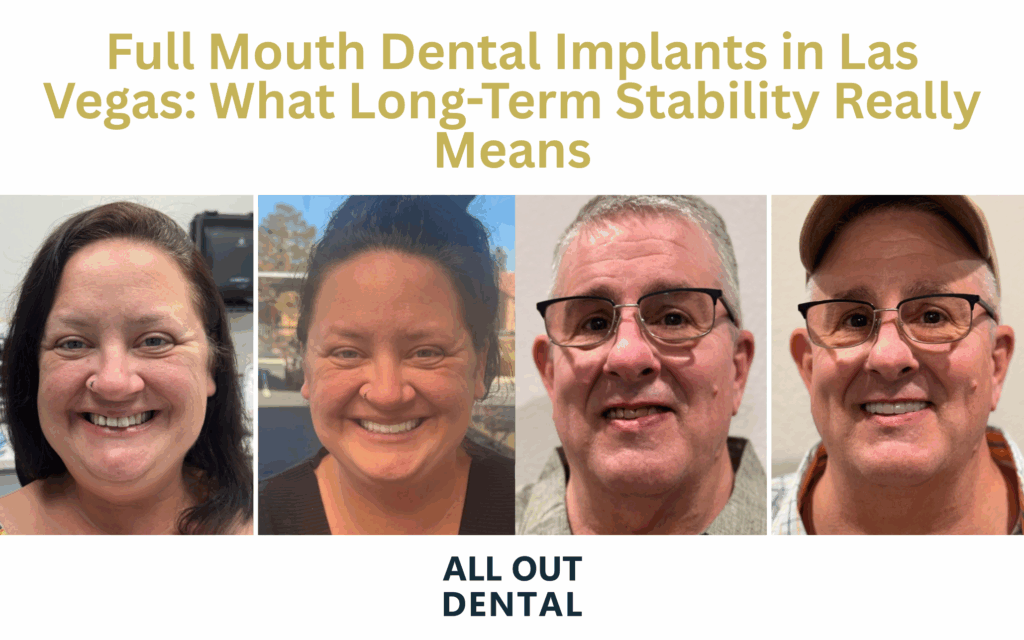 Long-Term Stability of Dental Implants | All Out Dental