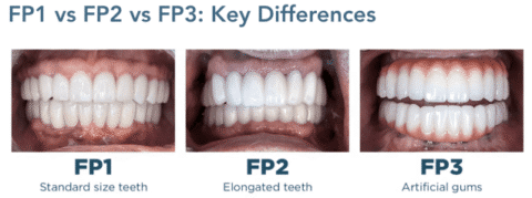 FP1 Dental Treatment: Why More Patients Choose It