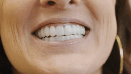 FP1 Dental Treatment: Why More Patients Choose It